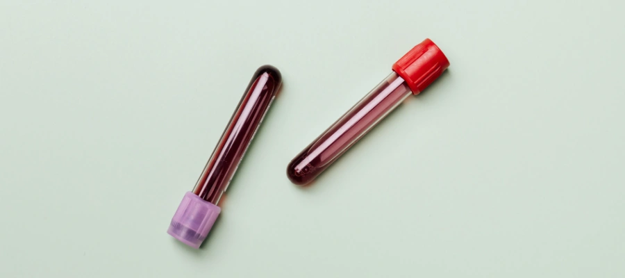 Why Should I Get Blood Work Done? | The Shot Nurse